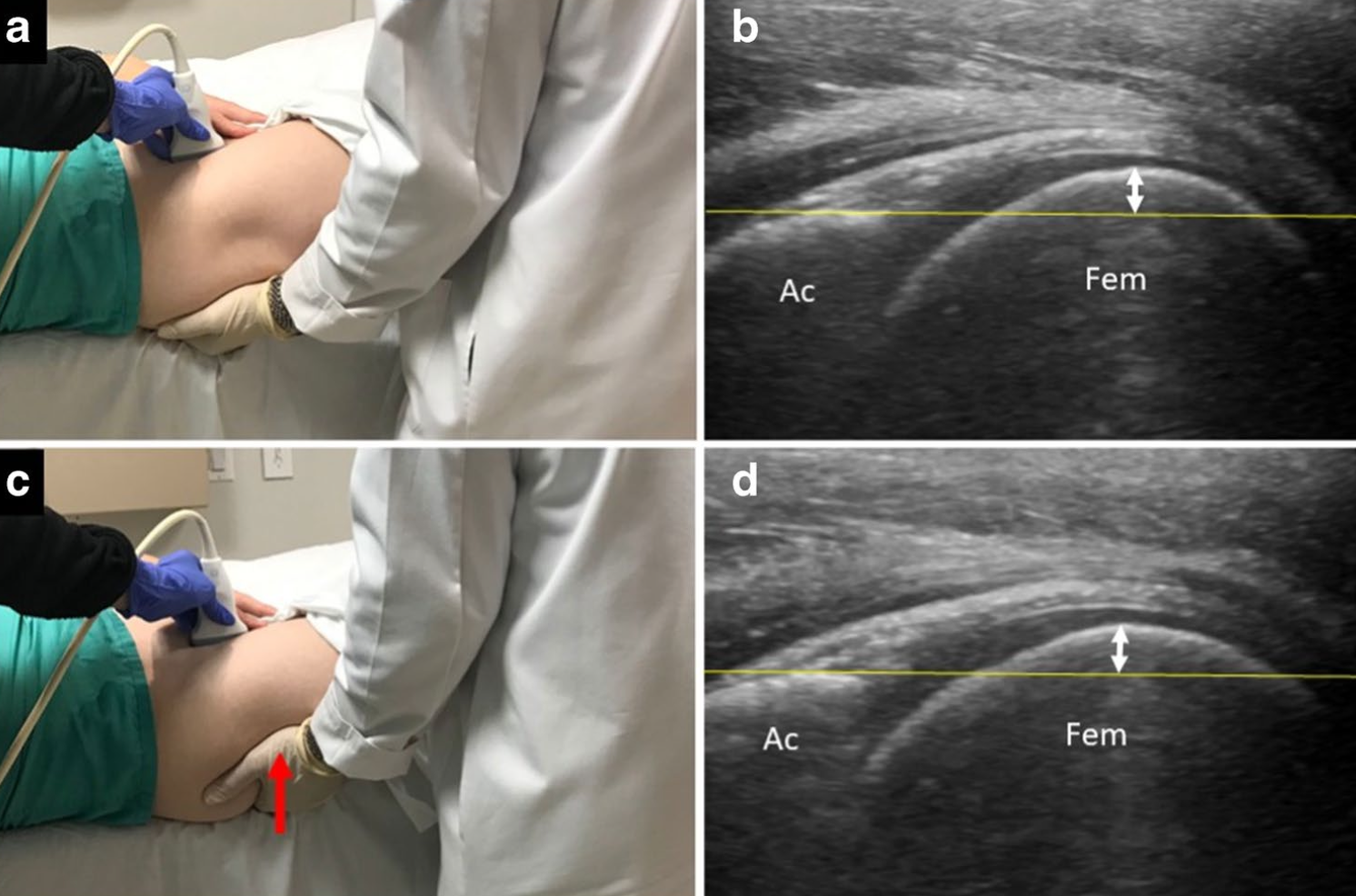 Joint Evaluation with MSK Ultrasound